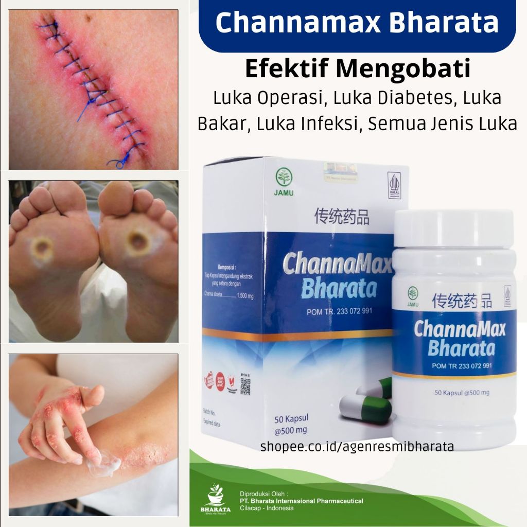 Jual Obat Luka Ampuh Original | Obat Luka Diabetes Gula Obat Luka ...