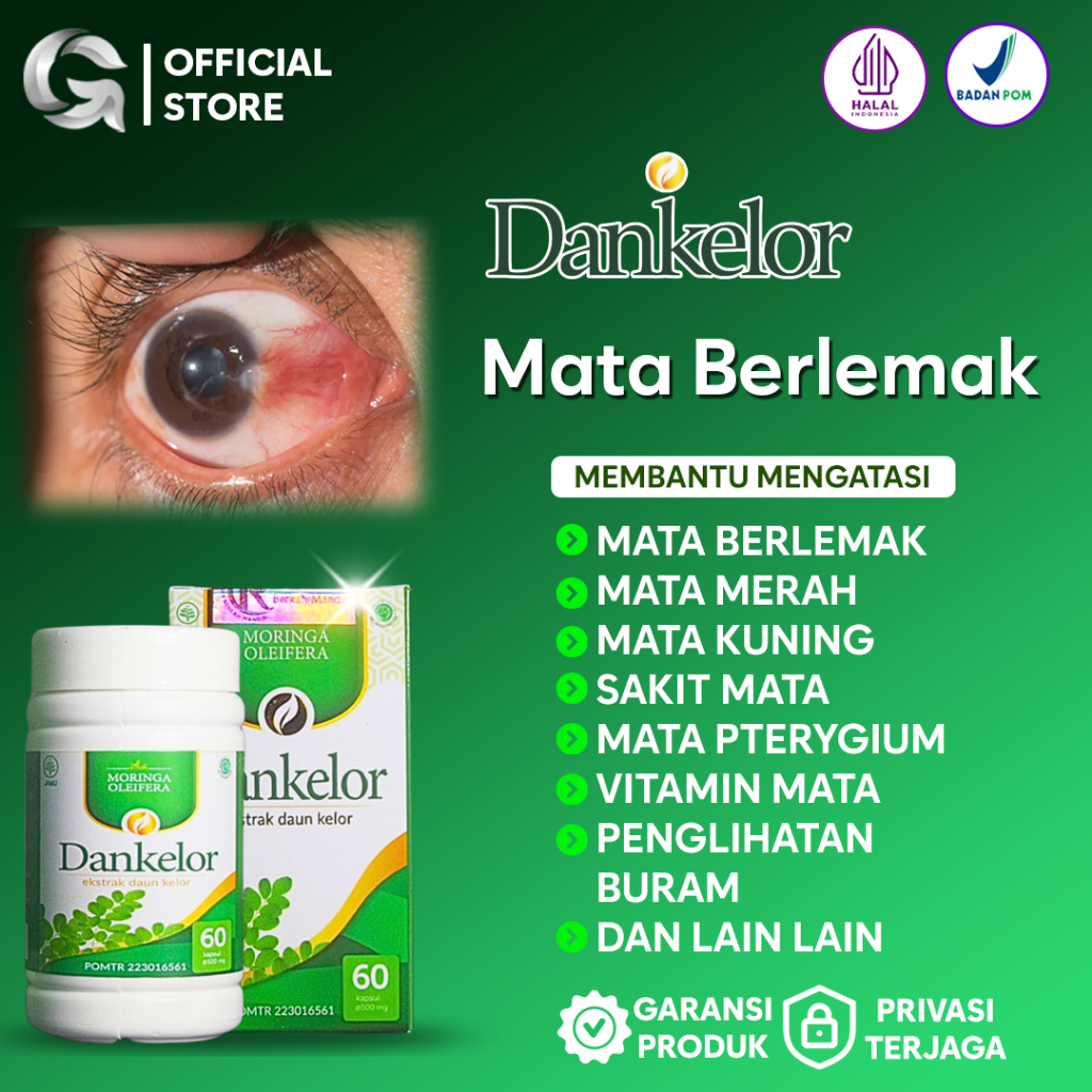 Jual Obat Mata Berlemak Mata Merah Mata Kekuningan Mata Pterygium Vitamin Mata - Ekstrak Daun ...
