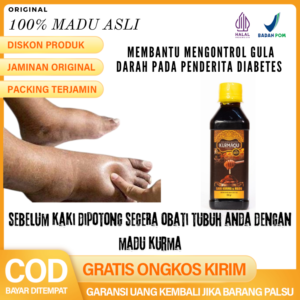 Jual Obat Gula darah Diabetes - mampu mengontrol gula darah madu asli ...