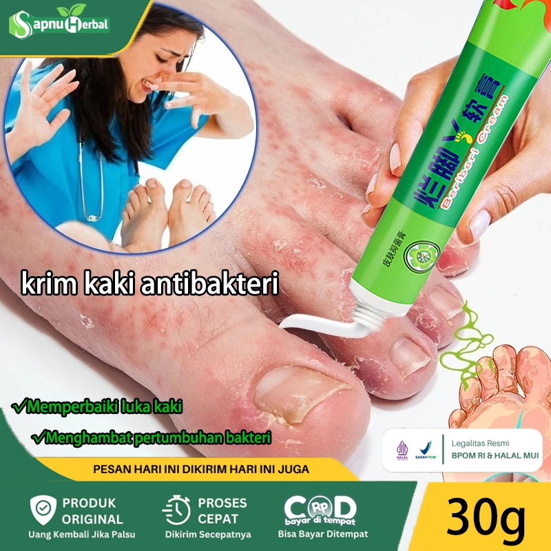 Jual Obat Kaki Rayapan Dan Bau Salep Obat Gatal Krim Pengelupas Kulit ...