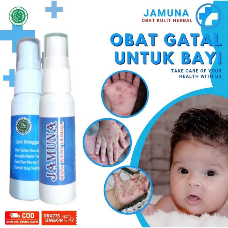 Jual OBAT GATAL PALING AMPUH , Obat Gatal Gatal Di Seluruh Badan ...