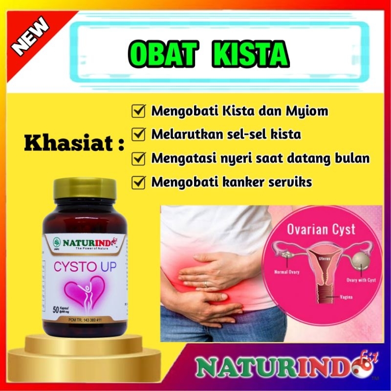 Jual CYSTO UP OBAT KISTA OVARIUM BARTHOLIN MIOM HERBAL KISTA GANGLION ...