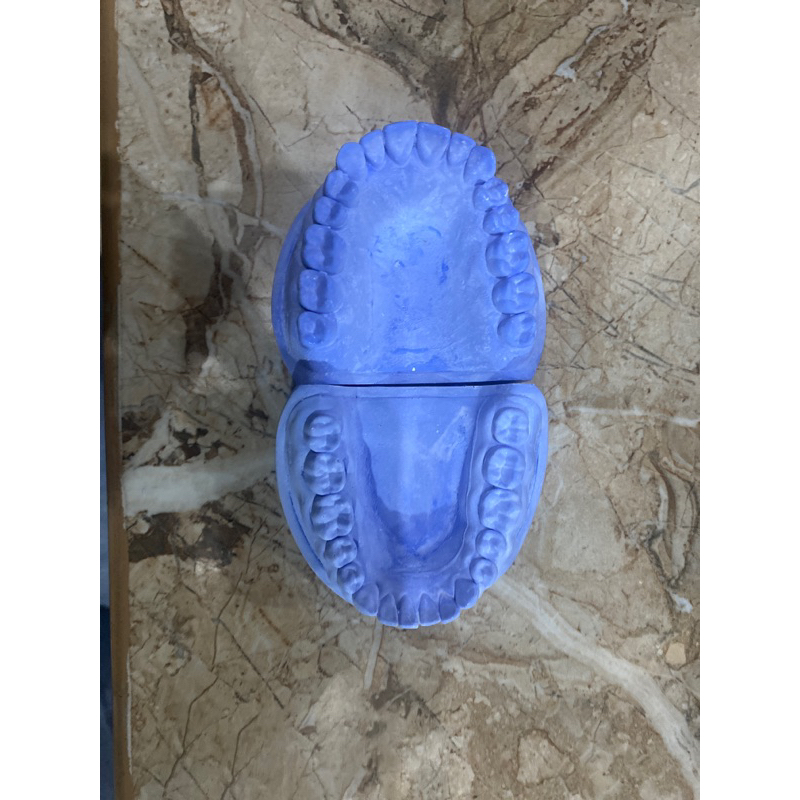 Jual Dental Model Gigi Stone Gips Lengkap / Model Study Edentulus ...