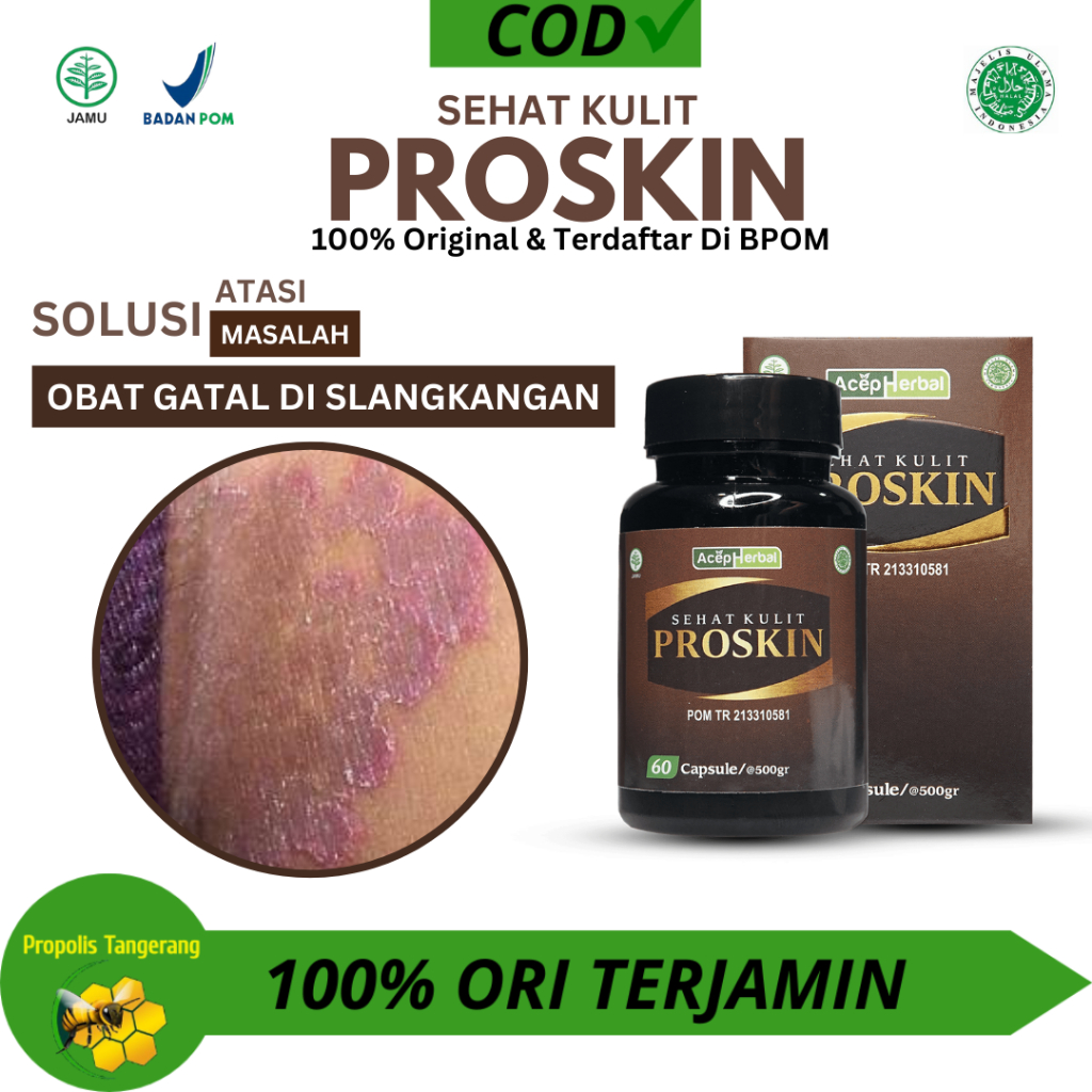 Jual Obat Gatal Gatal Di Slangkangan,Gatal Gatal Diseluruh Badan,Eksim ...