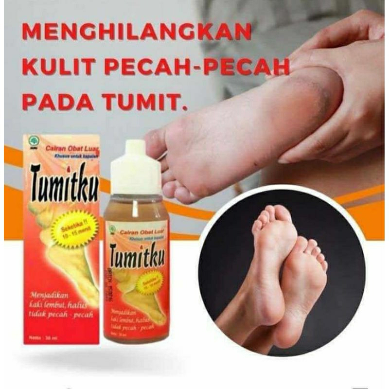 Jual TUMITKU MENGATASI KAKI PECAH/KAPALAN DENGAN INSTANT SUDAH,BPOM ...