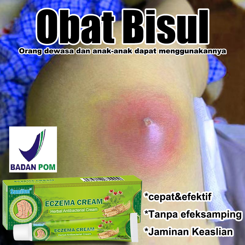 Jual Salep Bisul Obat Bisul Obat Bisul Anak 20g Obat Bisul Di Pantat Obat Bisul Pada Kelamin ...