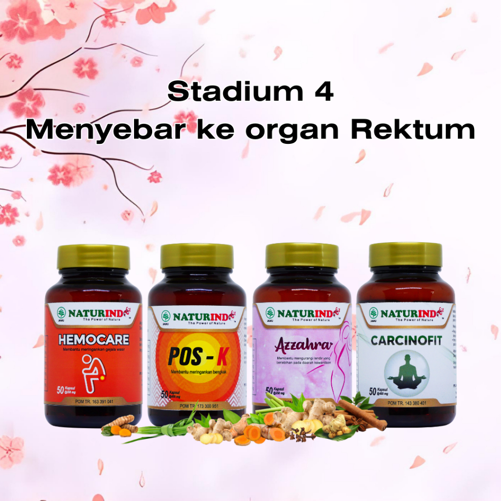 Jual Obat Herbal Kanker Serviks Cancer Leher Rahim Stadium 1 2 3 4 ...