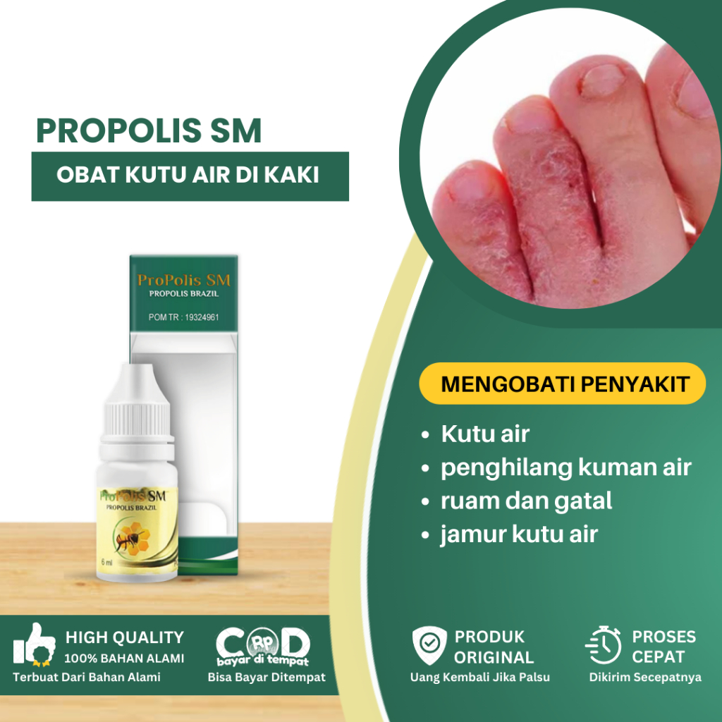Jual Obat Kutu Air Pada Kaki, Penghilang Kuman Air, Obat Kutu Air Ruam ...