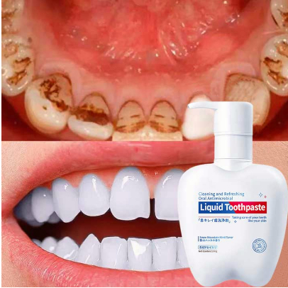 Jual Pemutih Gigi Pasta Odol pemutih gigi dan karang gigi Whitening ...