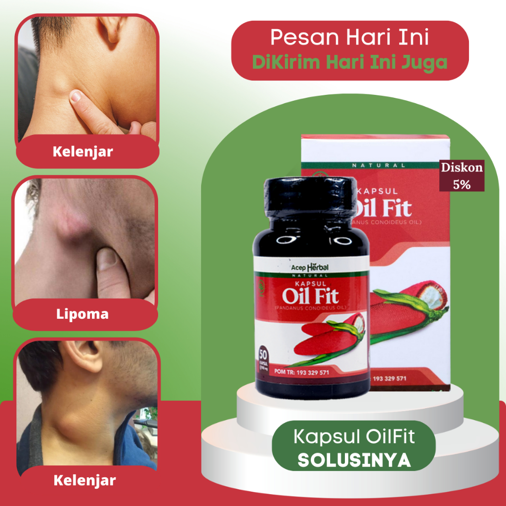 Jual Obat Benjolan di Leher, Tiroid Di Leher, Gondokan Beracun, Gondok ...