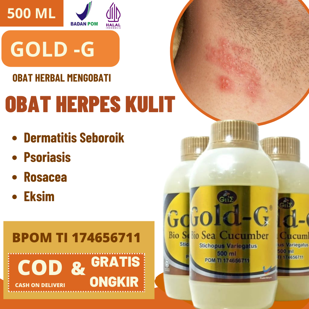 Jual Obat Herpes Kulit, Ruam Pada Kulit, Kulit Terasa Nyeri dan ...
