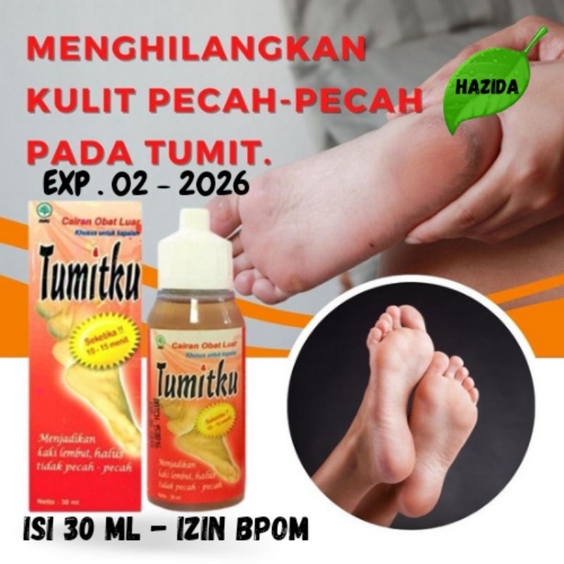Jual TUMITKU 30 ml Solusi Kaki Halus Tidak Pecah Pecah | Shopee Indonesia