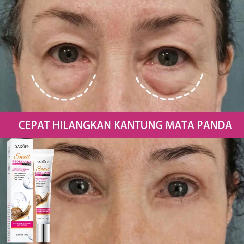 Jual Eye cream menghilangkan mata panda penghilang kantung mata krim ...
