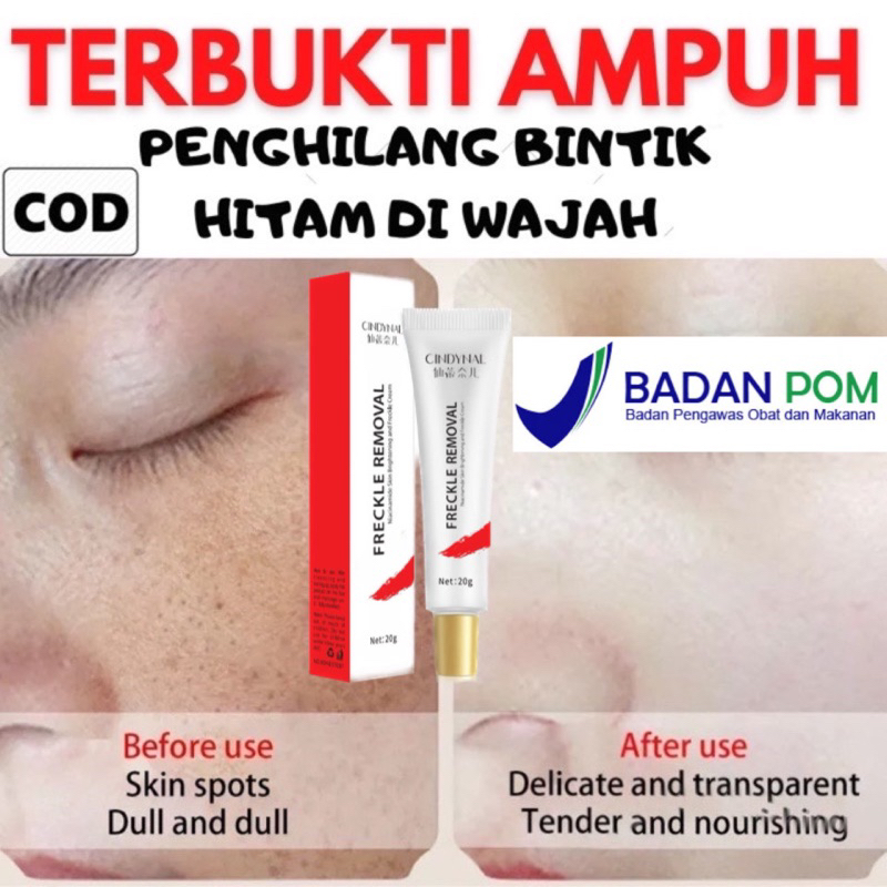 Jual Cream Penghilang Flak Hitam Membandel / Salep Pemutih Wajah / Krim Penghilang Flek Hitam ...