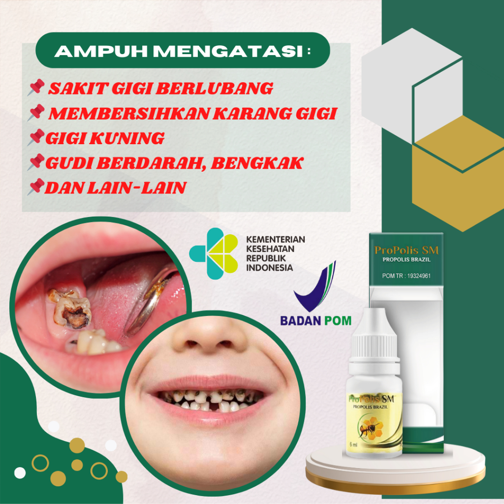 Jual Obat Sakit Gigi Berlubang Gusi Bengkak Nyeri Linu Bau Mulut Tak Sedap Dan Sariawan Polip ...