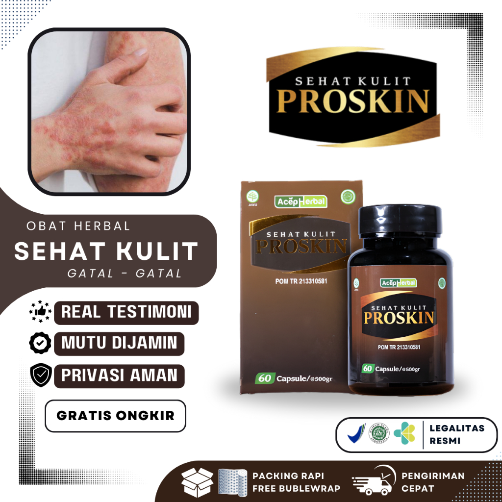 Jual Obat Gatal Biduran Jamur Panu Hapuran Kadas Kurap Eksim Kutu Air ...