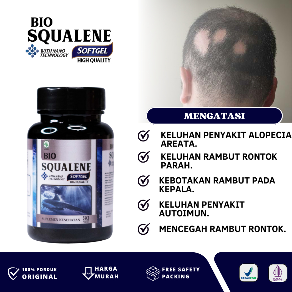 Jual Obat Alopecia Areata Rambut Pitak Kebotakan Rambut Pada Kepala ...