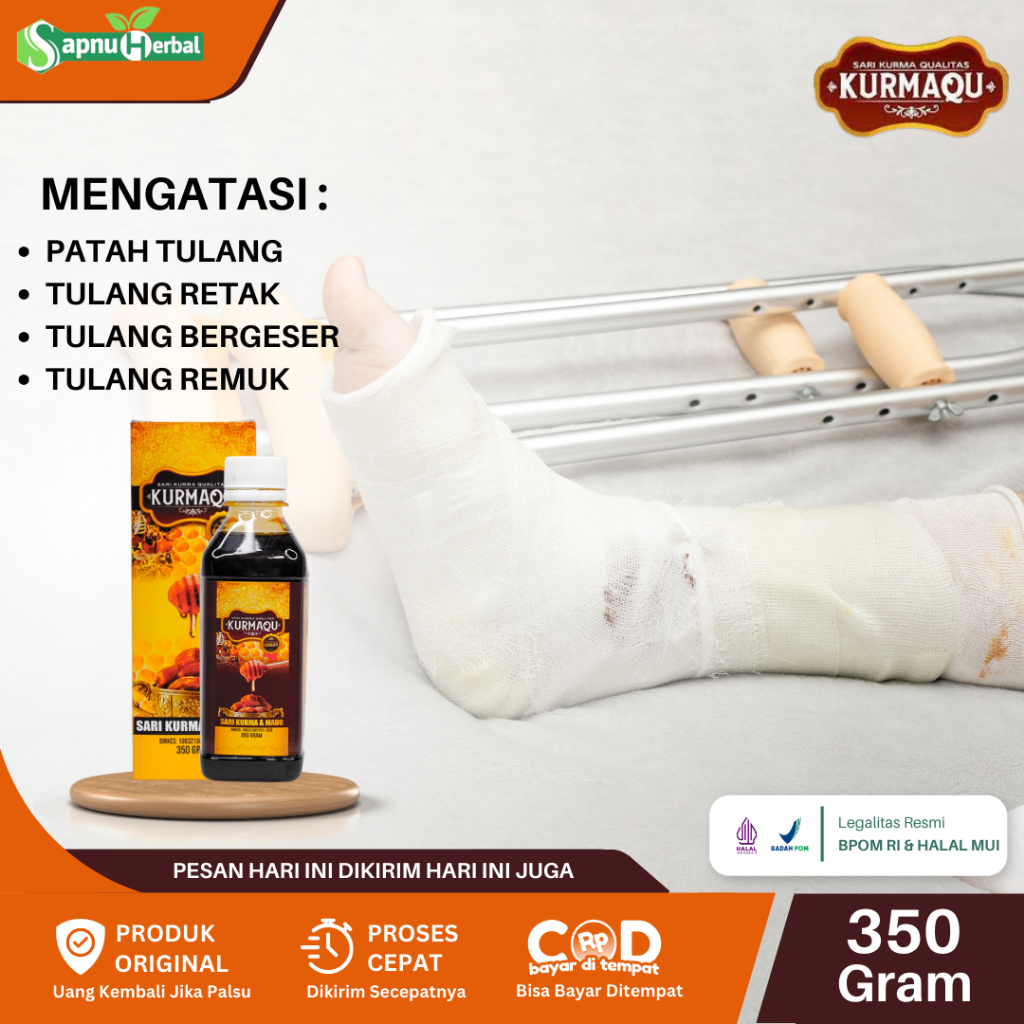 Jual Obat Patah Tulang Dan Retak Penyambung Perekat Nutrisi Tulang ...