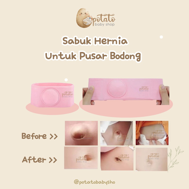 Jual Infantible Umbilical Hernia Belt - Sabuk pusar bodong Bayi ...