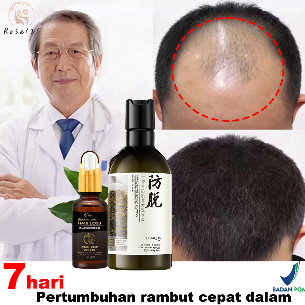 Jual [100% ORI] Shampo Penumbuh Rambut Cepat Serum Serum penumbuh ...