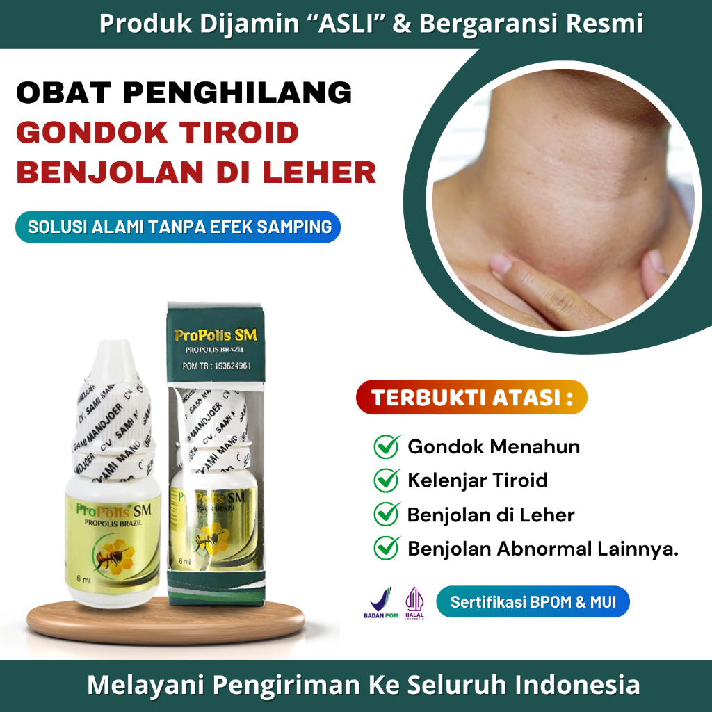 Jual Obat Gondok Tiroid Kelenjar Getah Bening Benjolan di Leher Menahun ...