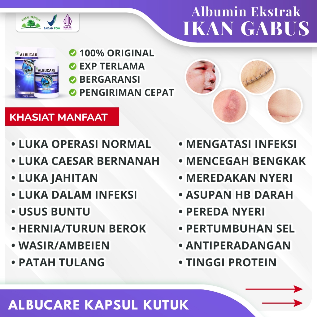 Jual Obat Anemia Kurang Darah Dewasa Penambah HB Hemoglobin Pasca ...