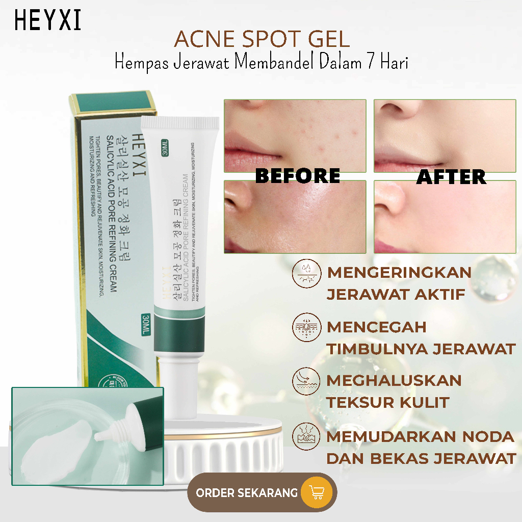 Jual HEYXI Acne Spot Gel Salicylic Acid Pore Refining Cream | Acne Gel ...