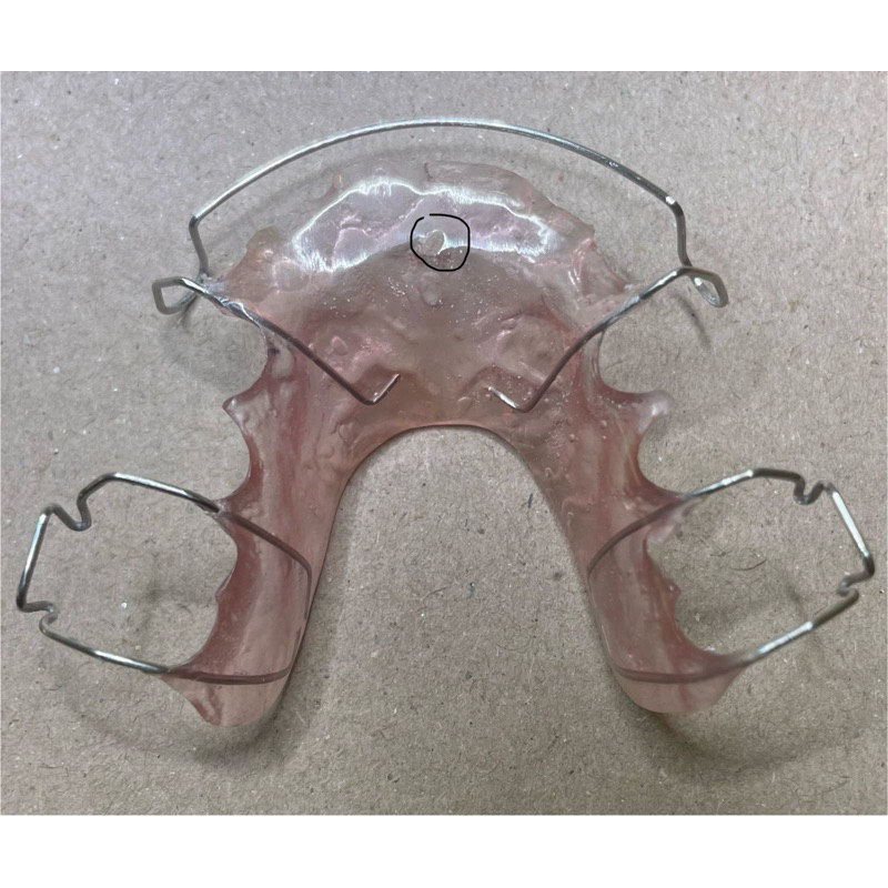 Jual Repair/Perbaikan Hawley Retainer | Shopee Indonesia