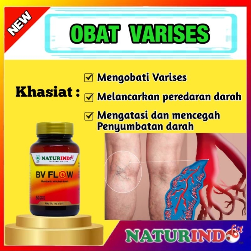 Jual OBAT VARISES KAKI TANPA SUNTIK MELANCARKAN PEREDARAN DARAH ...