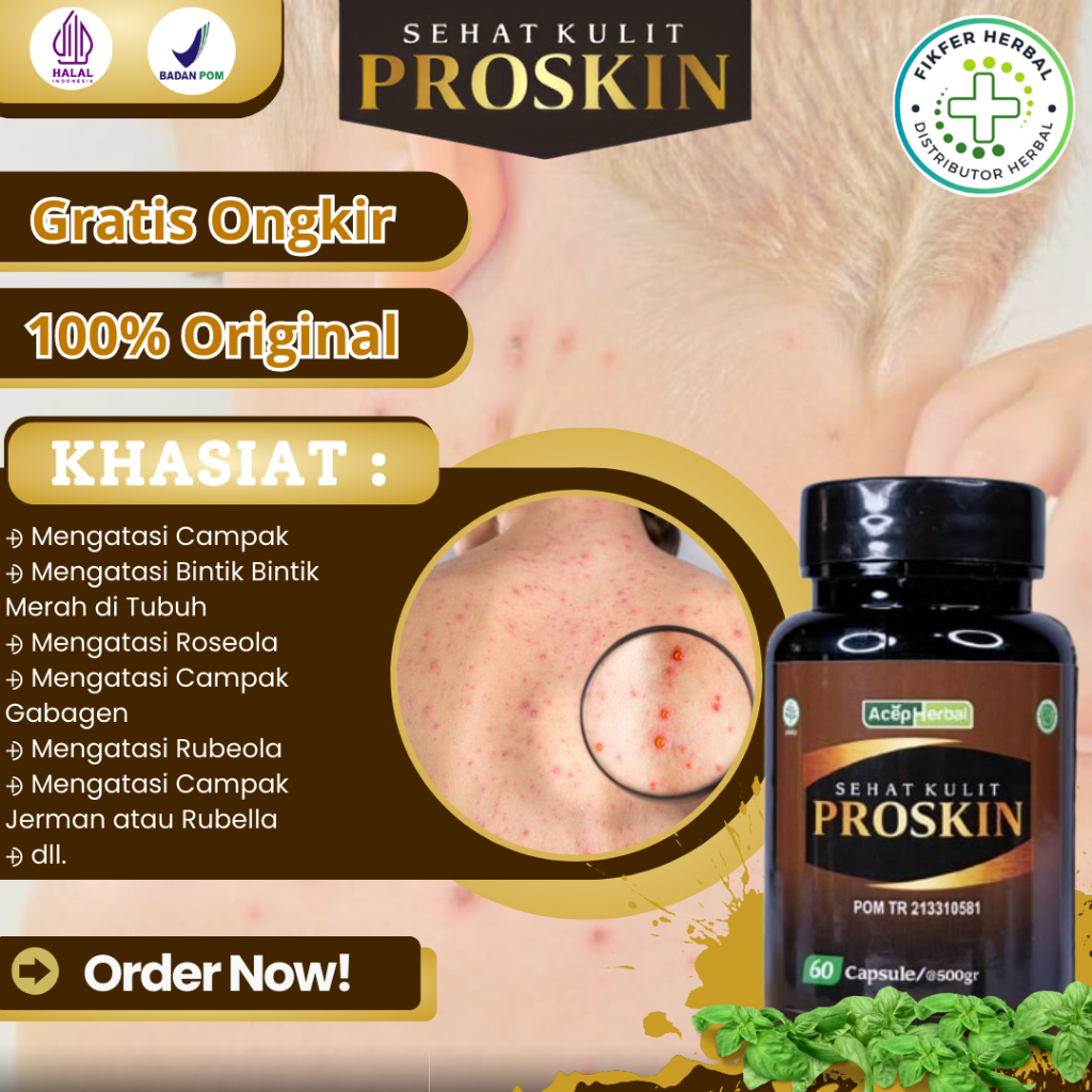 Jual Obat Campak, Campak Jerman / Campak Rebulla, Obat Campak Gabagen ...