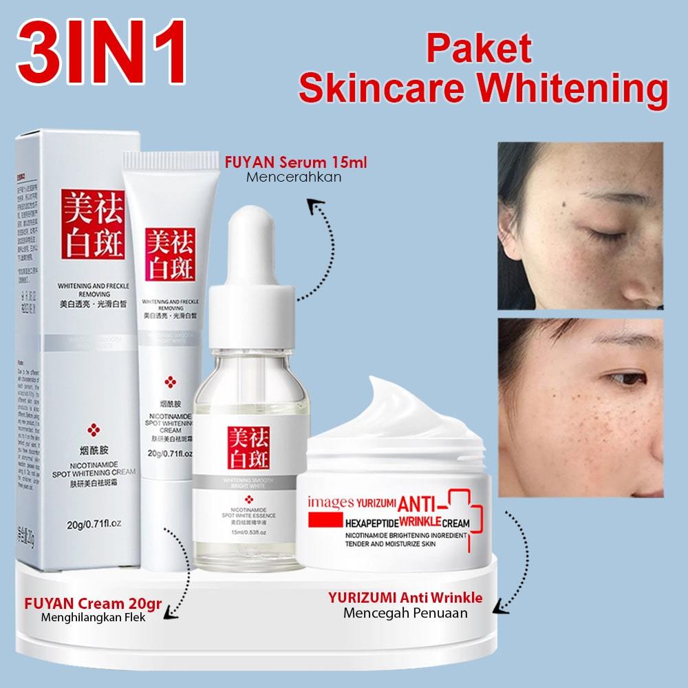 Jual [BUNDLE 3in1 MURAH] Set Perawatan Wajah Whitening Freckle Cream ...