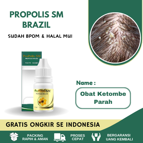 Jual Obat Ketombe Parah, Obat Ketombe Berkerak di Kepala, Obat Ketombe Parah Menahun, Obat Borok ...