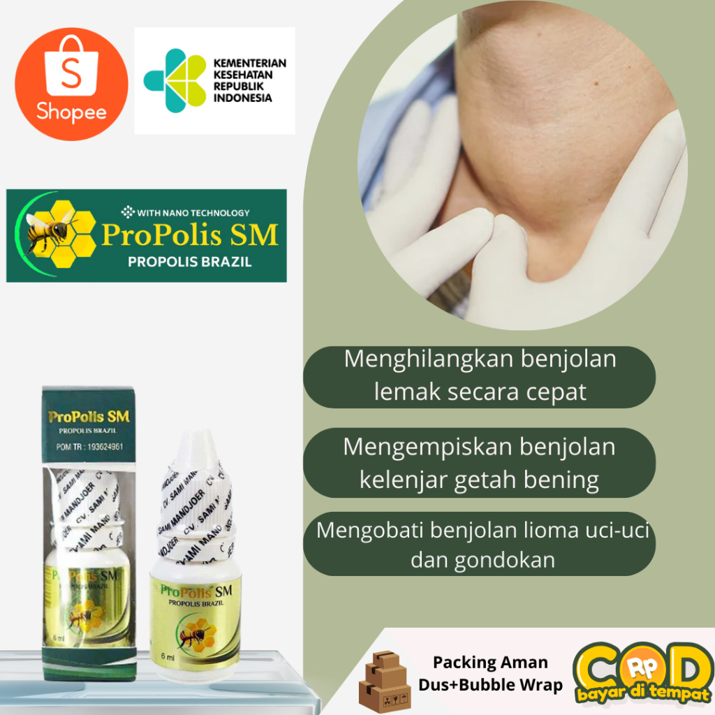 Jual Obat Kelenjar Getah Bening Benjolan Di Leher Pembengkakan Kelenjar ...