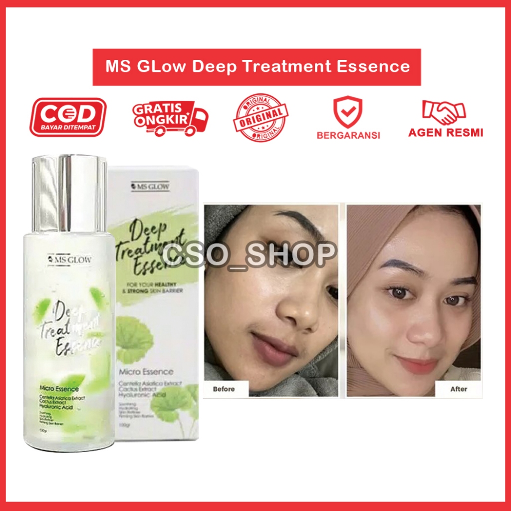 Jual MS GLow Deep Treatment Essence Glowing - MS Glow DTE Essense ...