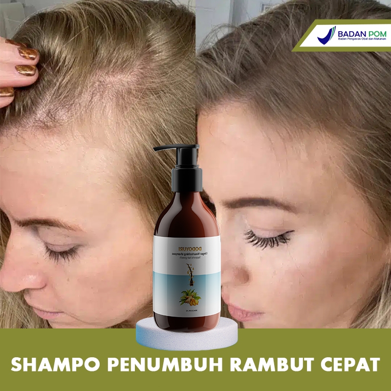 Jual [100% asli]sampo penumbuh rambut cepat sampo penumbuh rambut 300ml shampo anti ketombe ...