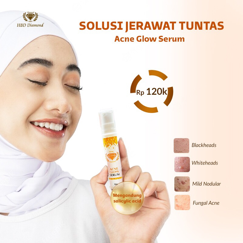 Jual Serum Acne Glow HBD Diamond Anti Acne Serum BPOM Serum Untuk Kulit Jerawat Halal Aman ...