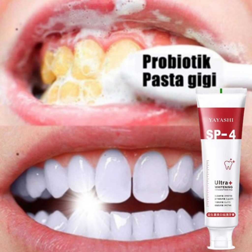 Jual Whitening toothpaste Pasta Gigi Probiotik SP-4 Gigi putih Pasta ...
