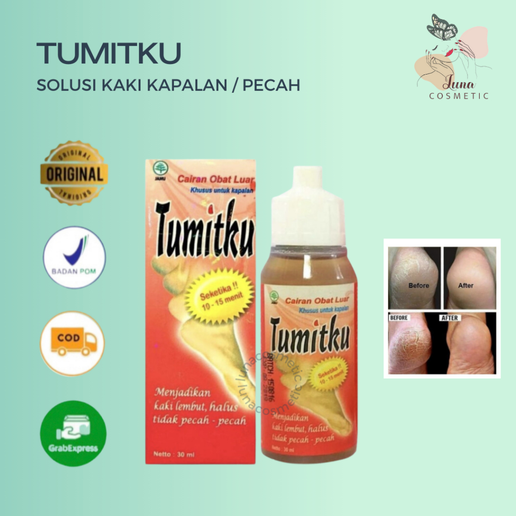 Jual TUMITKU BPOM mengatasi kaki kapalan dan pecah pecah | Shopee Indonesia