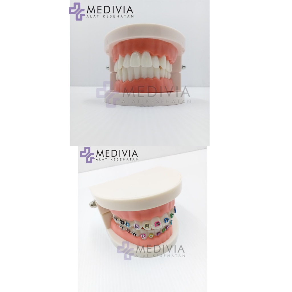 Jual DENTAL MODEL STUDY EDUKASI DOKTER GIGI PHANTOM STUDI RAHANG GIGI ...