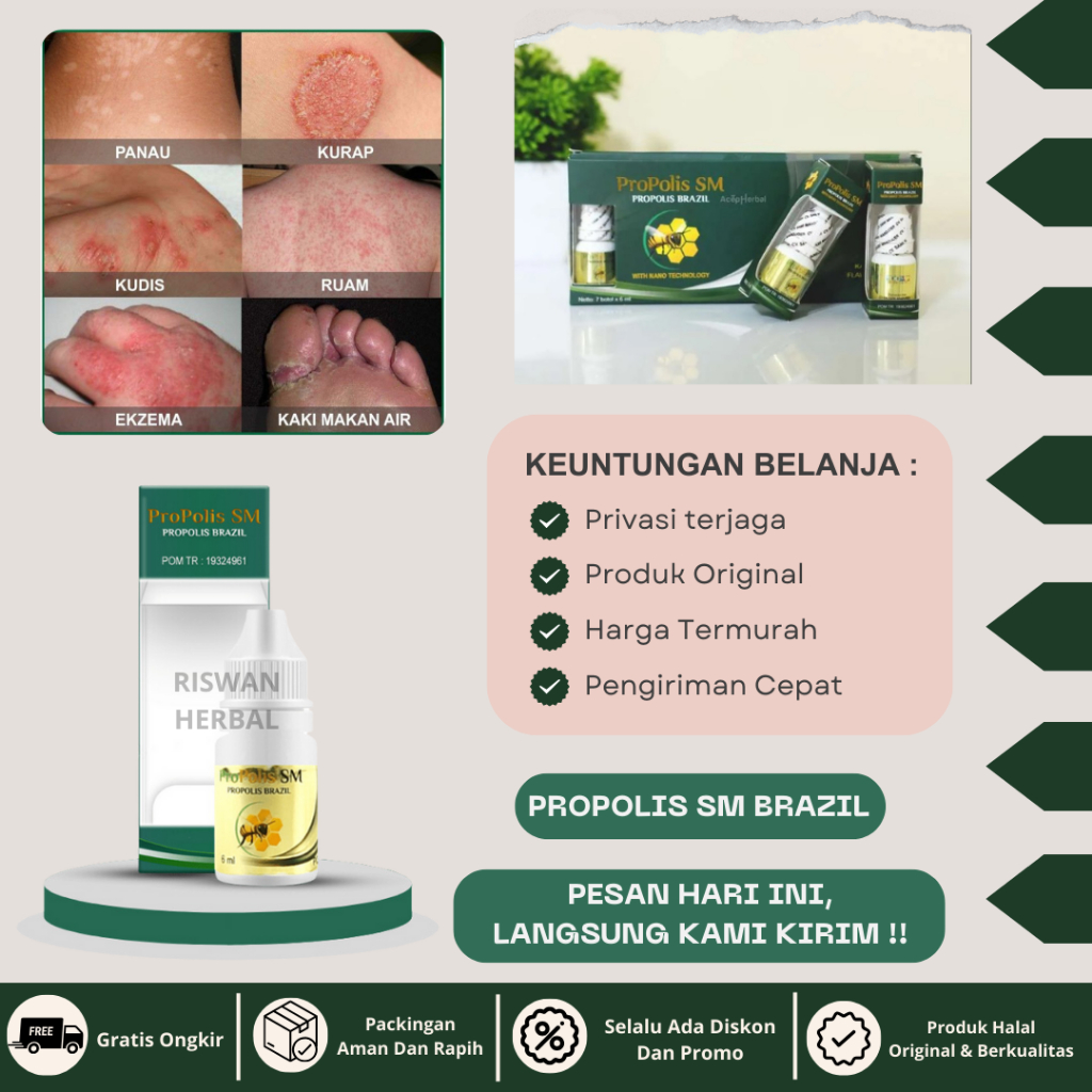 Jual Walatra Propolis SM - Obat Alergi, Bintik Merah, Gatal-Gatal ... Jual Walatra Propolis SM - Obat Alergi, Bintik Merah, Gatal-Gatal ...