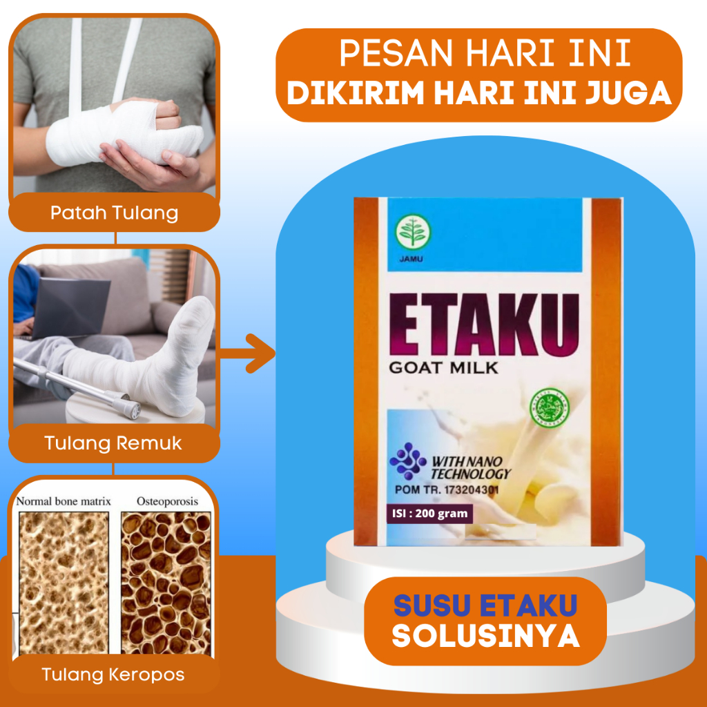 Jual Obat Patah Tulang Retak Remuk Tulang Bergeser - Susu Kalsium ...