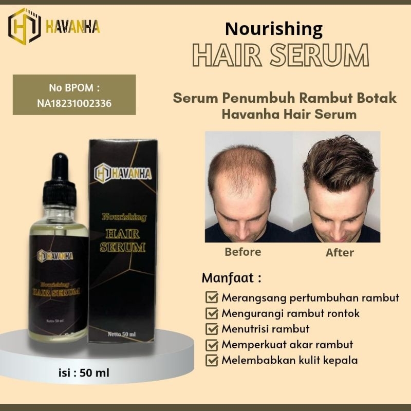 Jual HAVANHA PENUMBUH RAMBUT BOTAK Pria Cepat Hair Growth Serum Rambut ...