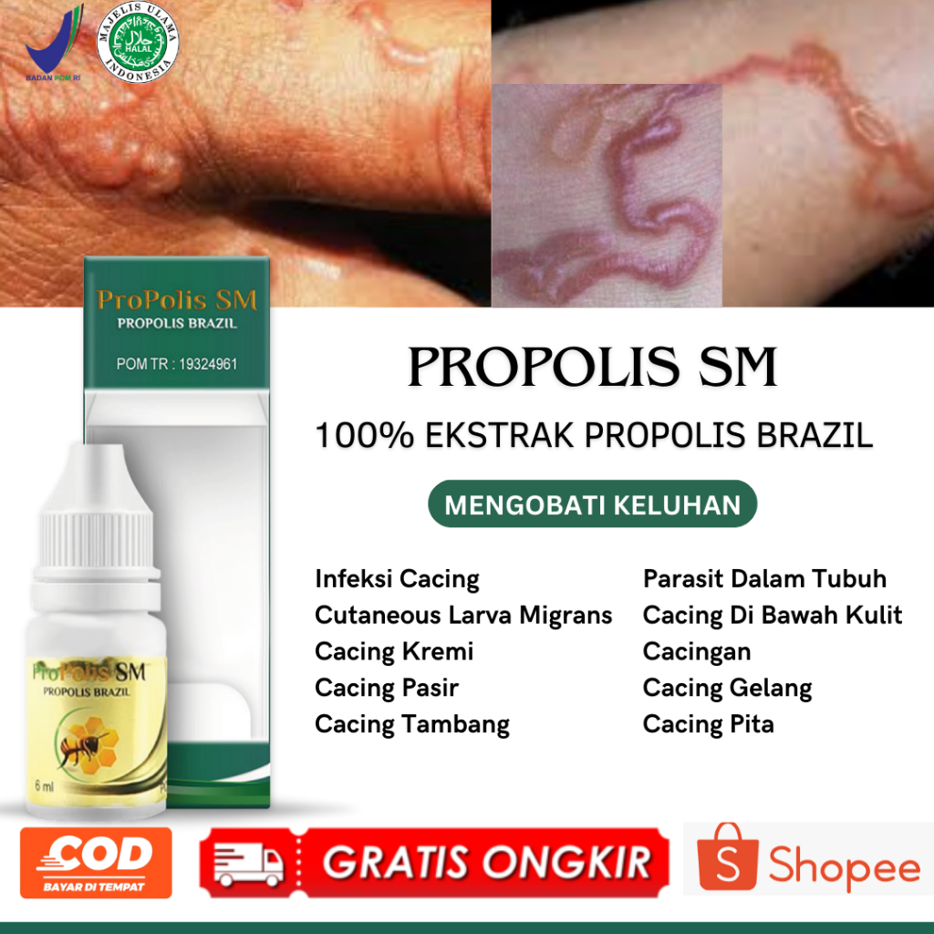 Jual Obat Cacingan Cutaneous Larva Migrans Penghilang Cacing Pasir ...
