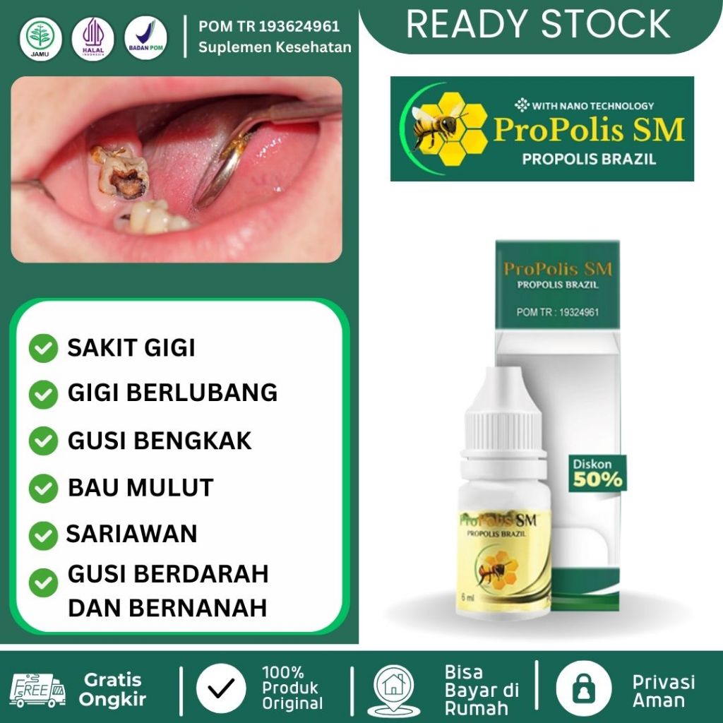 Jual Obat Sakit Gigi Berlubang Untuk Anak dan Dewasa Gusi Bengkak Berdarah dan Bernanah Radang ...