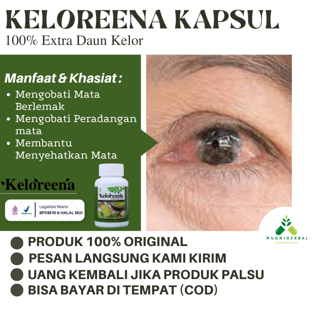 Jual Keloreena - Obat Mata Berlemak, Pterygium, Selaput Mata Berlemak ...