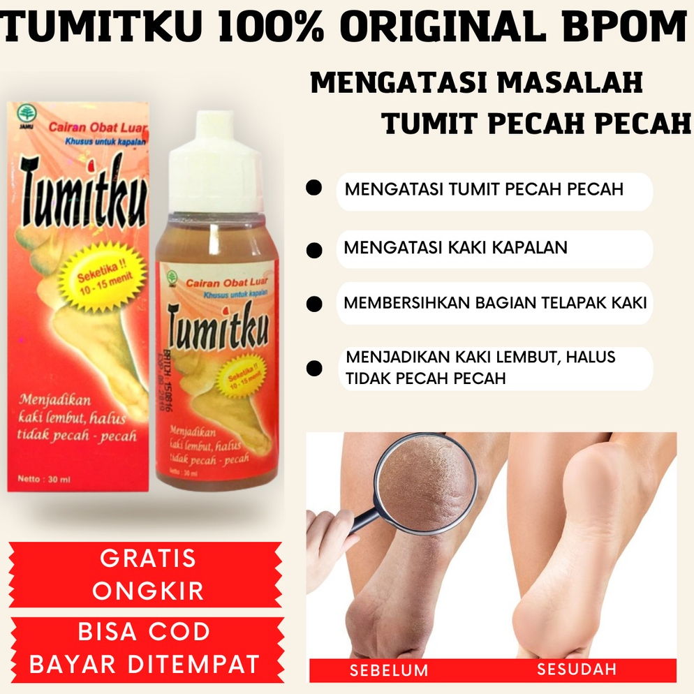 Jual Tumitku Obat Kaki Pecah Original Bpom Tumit Pecah dan Kering ...