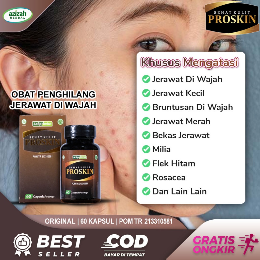 Jual Obat Penghilang Jerawat Bruntusan Milia Flek Hitam Bintik Merah ...