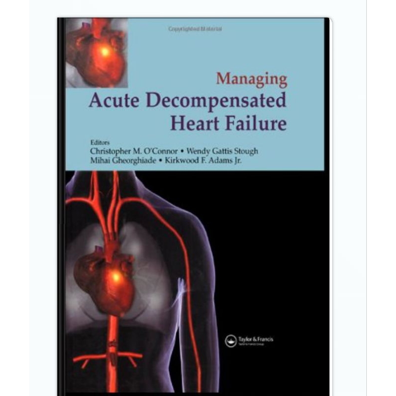 Jual Management of Acute Decompensated Heart Failure | Shopee Indonesia