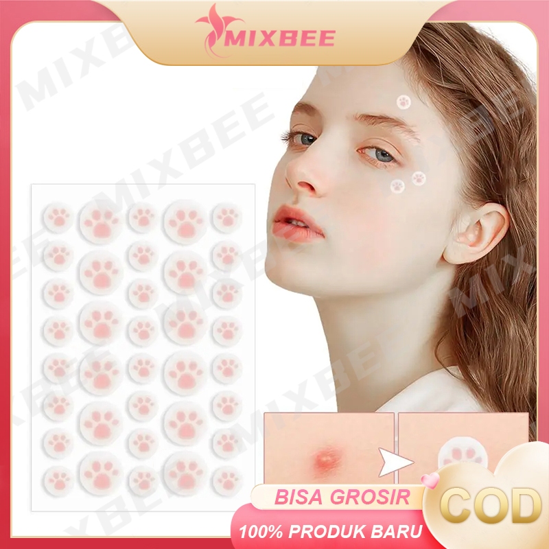 Jual Stiker Berwarna-warni Acne Patch Koyo Jerawat Bentuk Bintang/Hati ...