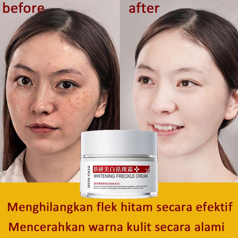 Jual Whitening Freckle Cream Krim Pemutih Penghilang Bintik Wajah, Krim Asli Efektif ...